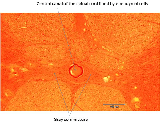 The spinal cord – Morphology of Nervous System
